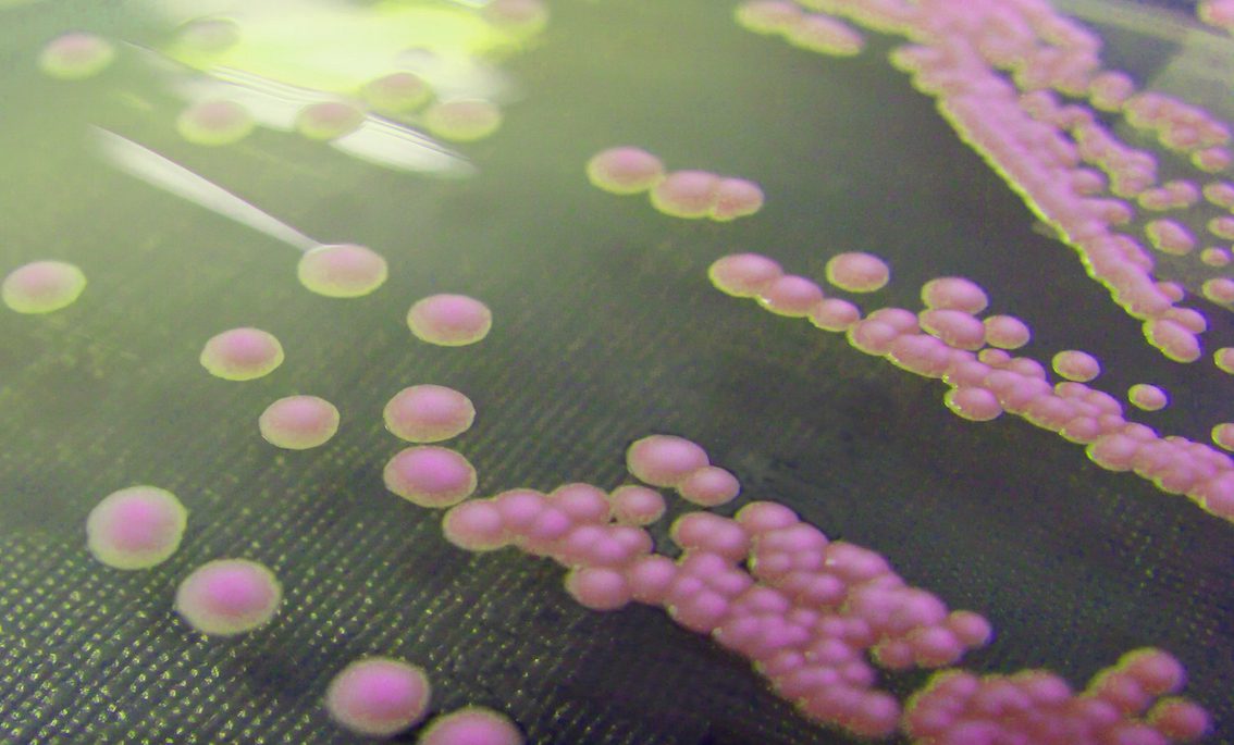 Malattia di Crohn, tra le cause spunta un fungo presente nell’intestino