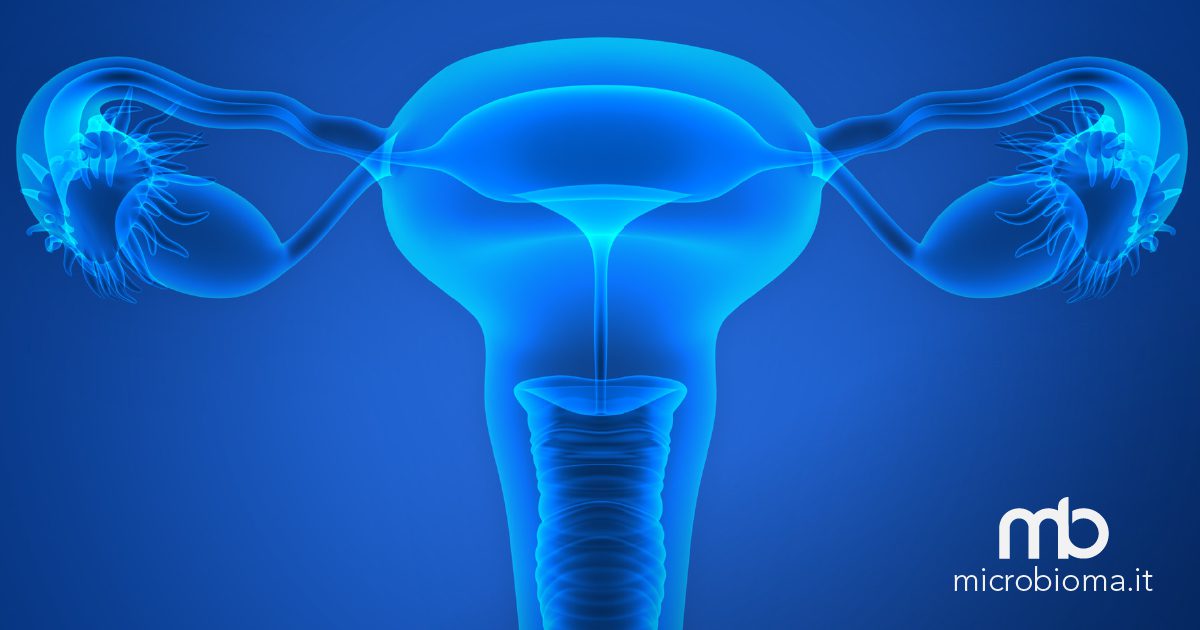 Ovaio policistico: iperandrogenismo modifica il microbiota intestinale