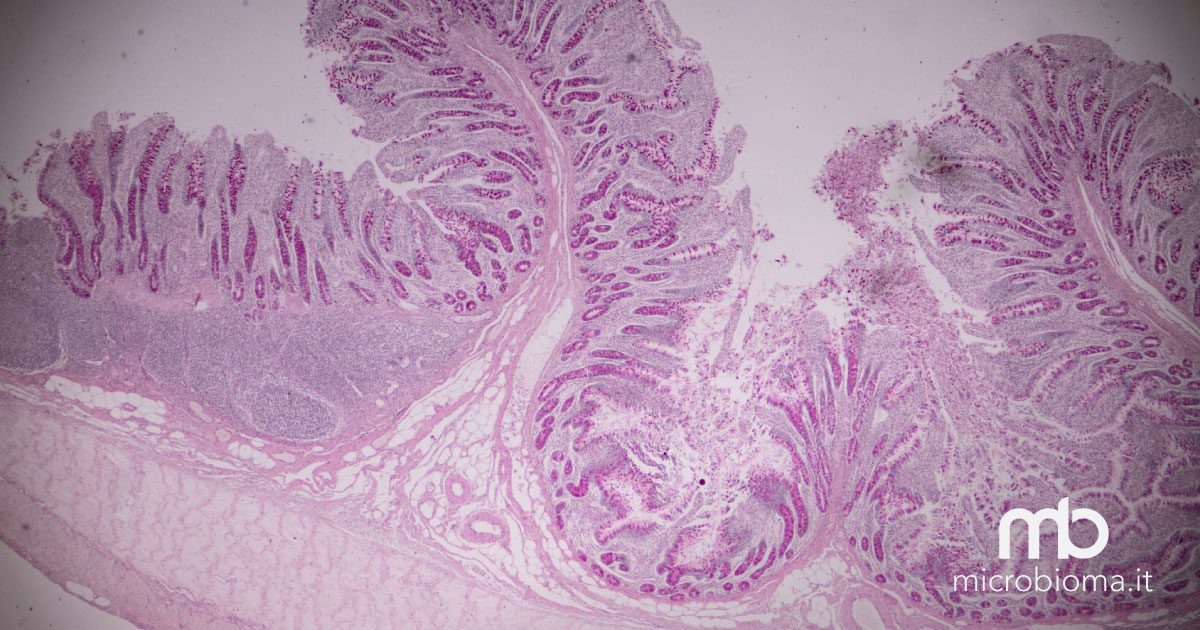 Un modello murino migliore per la malattia di Crohn