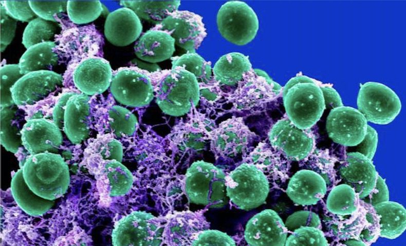 Bayer: partnerhip con Azitra per sviluppare probiotici per pelle ...