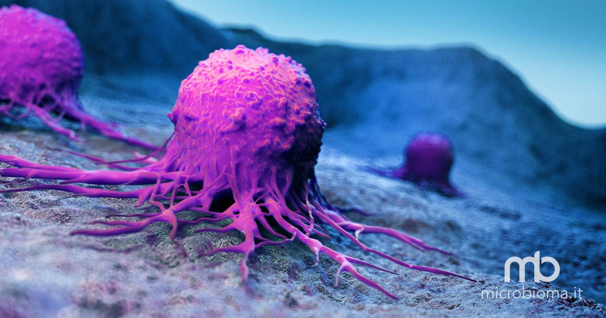 Tumori testa-collo: microbioma orale biomarker per diagnosi nei fumatori