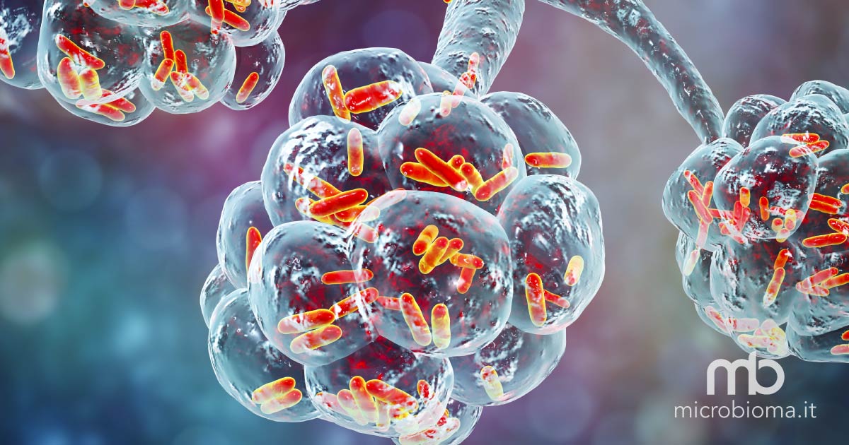 Polmoniti: nuovo studio indaga il ruolo protettivo del microbiota delle ...