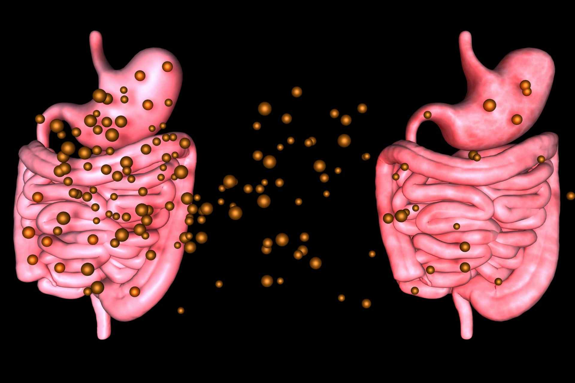 Trapianto di microbiota: il successo clinico dipende dal grado di ...
