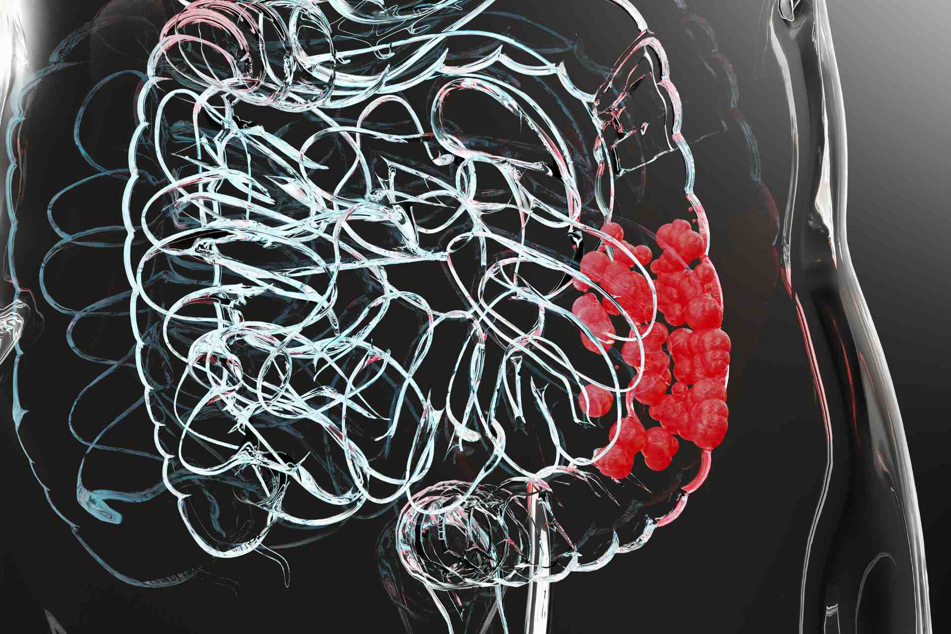 Effetti di specifici prebiotici in pazienti con tumore del colon-retto