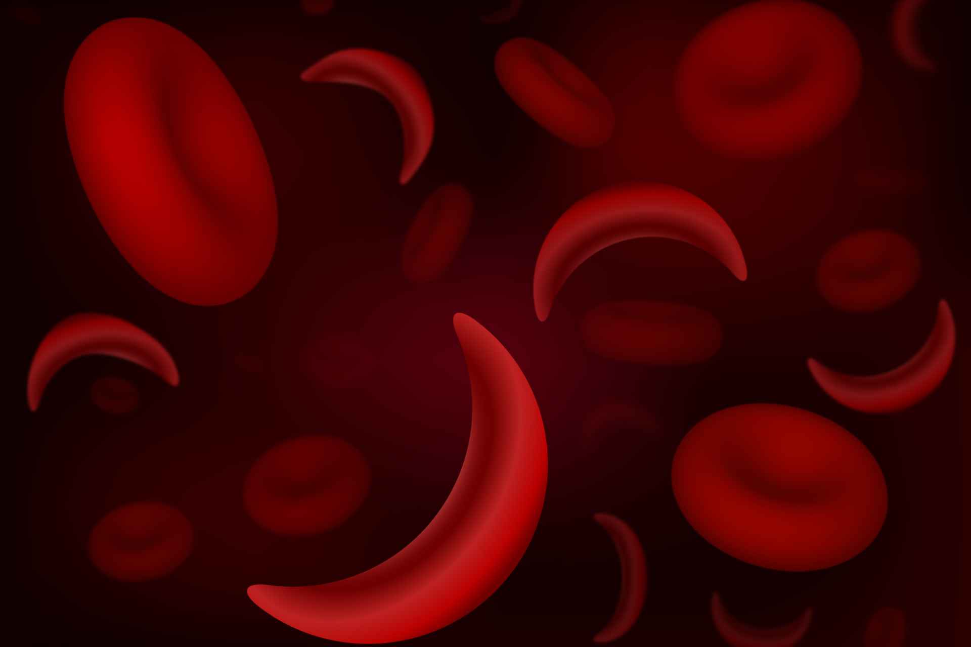 Anemia falciforme: possibile ruolo di Akkermansia muciniphila nel ...